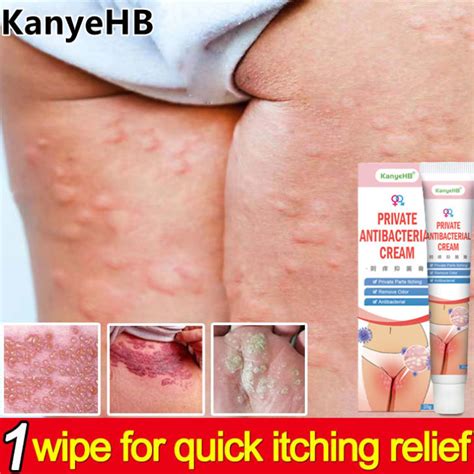 Kanyehb Private Antibacterial Cream 20g Relieves Ltching Quickly No