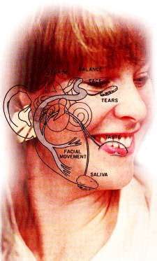 荃話題 貝爾氏麻痺Bell s Palsy