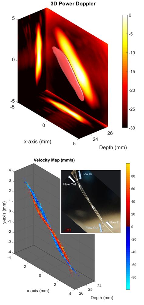 3 D Super Resolution Ultrasound Imaging With A 2 D Sparse Array Sevan
