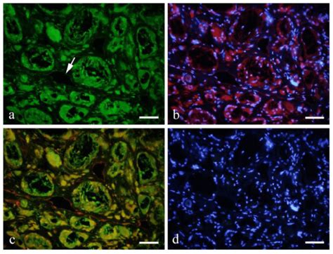 Double Staining With Gfp Green A And Cd31 Red B With Dapi Showed Download Scientific