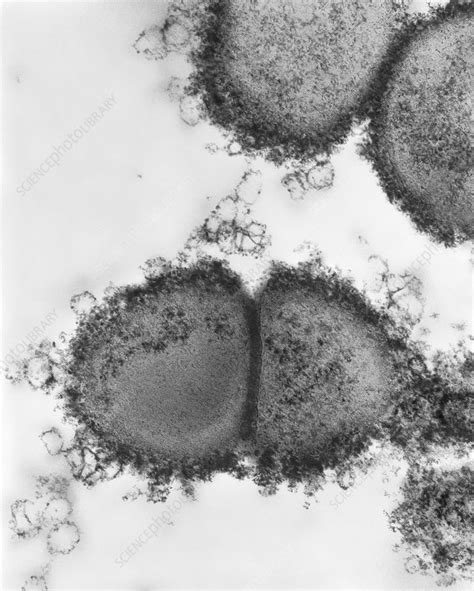 Streptococcus Bacteria Stock Image B236 0120 Science Photo Library