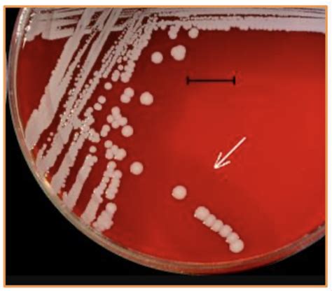 Lec 05 Staphylococcus Spp Flashcards Quizlet