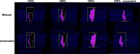 Comparison Of Multi Leaf Collimator Mlc Pairs Between The Manual And Download Scientific