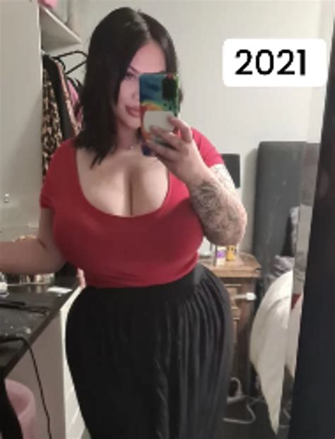 A Woman With Rare Condition Spends Terrifying Sums To Buy A Bra As Her Breasts Wont Stop