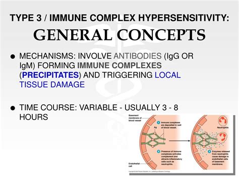 Ppt Immune Disorders Overview General Concepts Powerpoint Presentation Id 860175