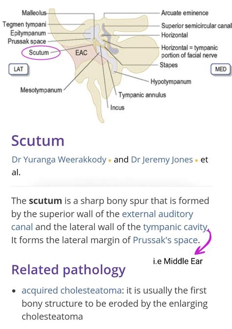 Scutum Temporal Bone