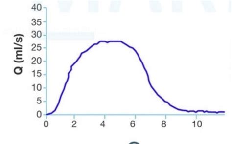Surgery Gt Points Flashcards Quizlet