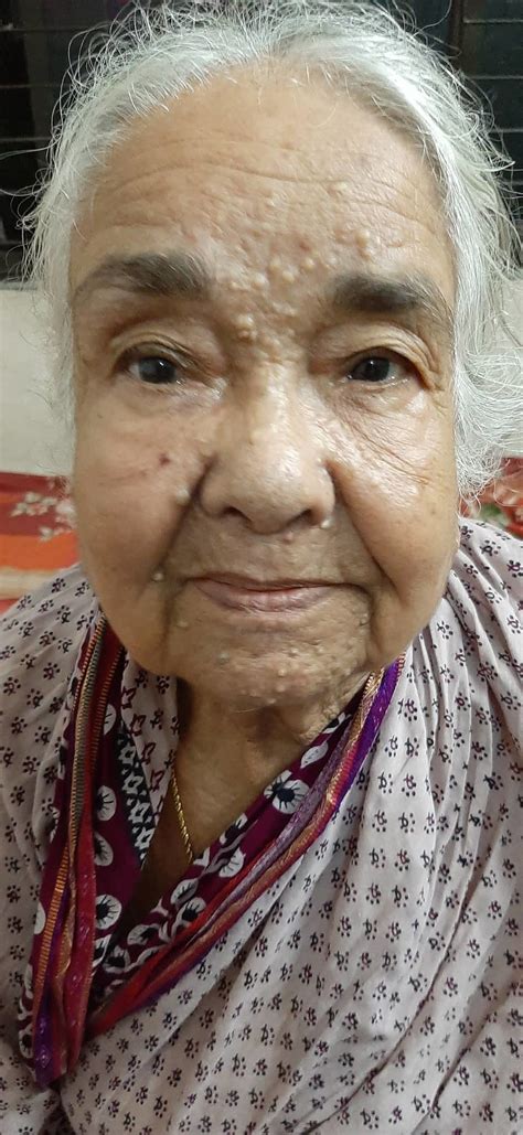 What Will Be The Diagnosis And Differential Diagnoses Of This Patient