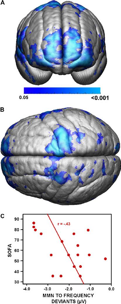 A Anterior View And B Superior View Of Correlation Maps Between Download Scientific Diagram