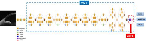 Figure 2 From Automatic Anterior Chamber Angle Classification Using Deep Learning System And