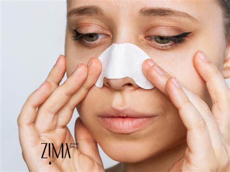 انواع و علت جوش روی بینی و راه های درمان آن زیمالب