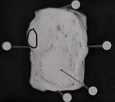 Inferior Plantar Surface Of Medial Cuneiform Diagram Quizlet