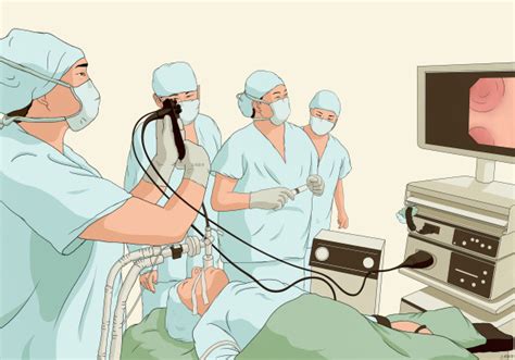 支气管镜检查 医学插画