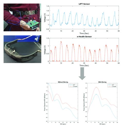 Sample Of Rr Signal Processing And Rr Derivation Obtained From Patient