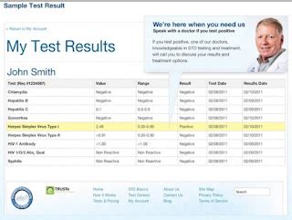 How Long Do Std Test Results Take