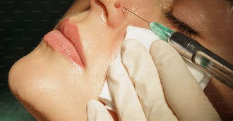 의료 미용 클리닉에서 두더지 제거 치료 전에 국소 마취제를 주사하는 여성 고객 사진 Unsplash의 라트비아 이미지