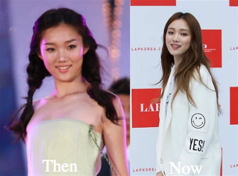 Lee Sung Kyung Plastic Surgery Before And After Photos Latest Plastic
