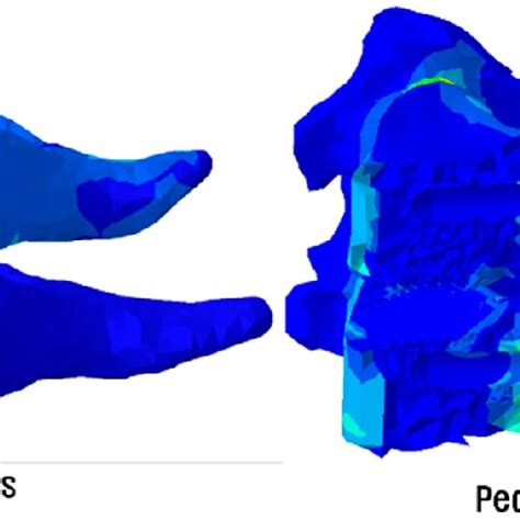 Load Sharing Distribution Diagram From FEM Analysis Adapted From 14 Download Scientific