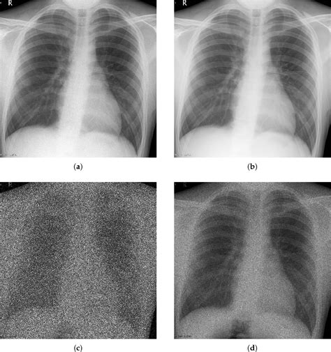 Figure 5 From Poisson Gaussian Noise Analysis And Estimation For Low Dose X Ray Images In The
