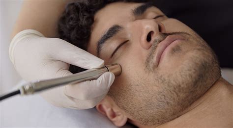 Illuminating The Path A Deep Dive Into Laser Treatments For Pore Refinement Stonesmentor