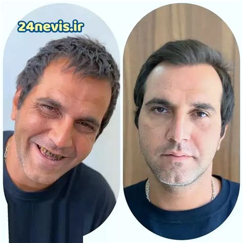 بیوگرافی افشین غیاثی بازیگر نقش جاوید در سریال سوجان عکس 24 نویس