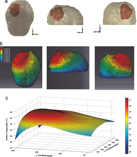 A Computational 3d Model Of A Real Brain Including A Tumor B Download Scientific Diagram
