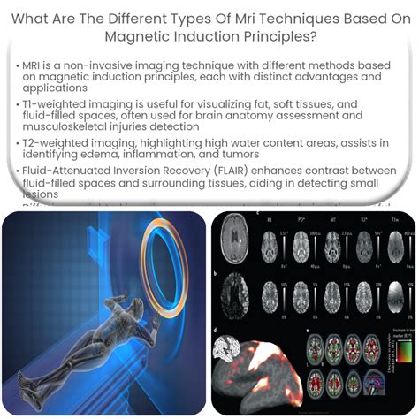 4 Examples Of Most Common Magnetic Resonance Imaging Mri Techniques