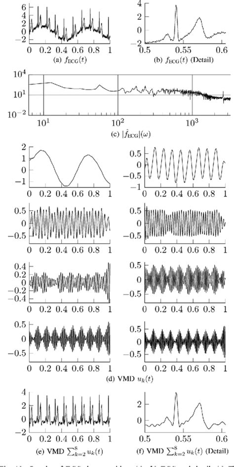 Variational Mode Decomposition Semantic Scholar