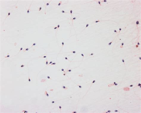 Filetestis Histology 015 Embryology