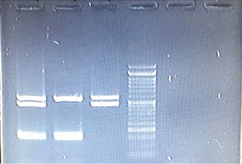 Tetra Arms Pcr Products Of Different Alleles Of Tiparp Gene Rs2665390