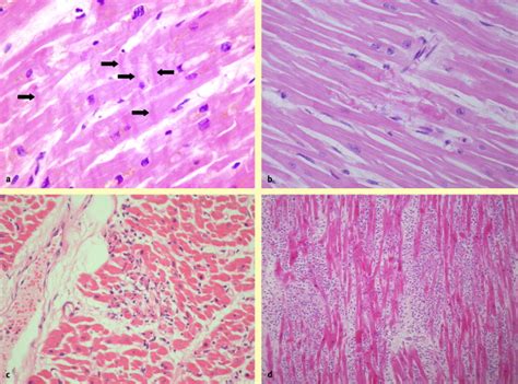 Pathology And Investigation Of Potentially Hereditary Sudden Cardiac Death Syndromes In