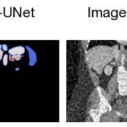 Sampled Abdomen Input Image And Segmentation Output For UNet And Download Scientific Diagram