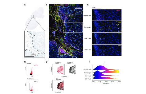 Cell Distribution And Tumor Microenvironment Characterization By Imc