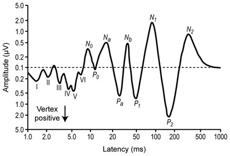 Evoked Potentials Auditory Auditory Evoked Potentials Auditory Evoked Response
