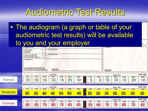 Audiometric Testing Ppt