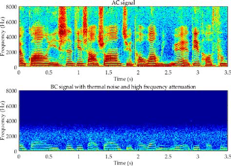 Figure 1 From A Real Time Dual Microphone Speech Enhancement Algorithm Assisted By Bone