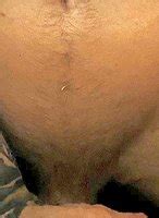 Aaron Carter Page Lpsg