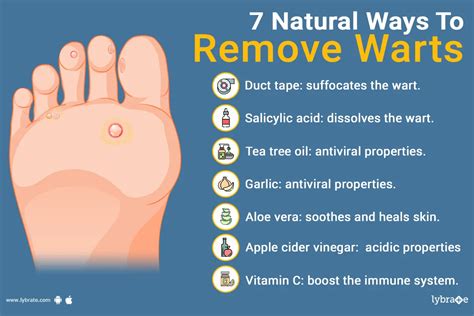 Preventing Genital Warts Tips And Strategies Ask The Nurse Expert