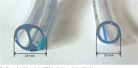 Figure 1 From Thyromental Height Test As A New Method For Prediction Of Difficult Intubation
