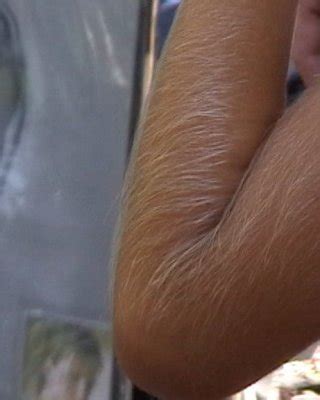 Girls With Hairy Arms Porn Pictures Xxx Photos Sex Images Page Pictoa