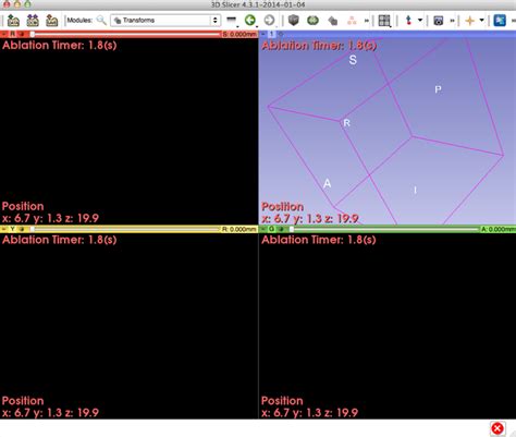documentation 4 8 modules cornerannotation slicer wiki