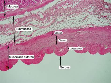 Duodenum Slide Labeled