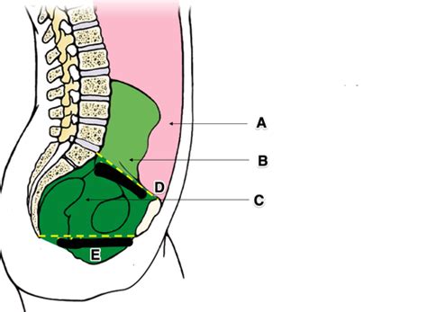 Anatomy U2d2 Pelvic Pics Flashcards Quizlet