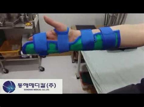 NEW Pre Mold SPLINT YouTube