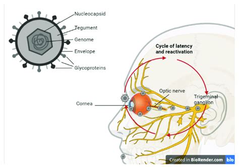 Trigeminal Ganglion Herpes