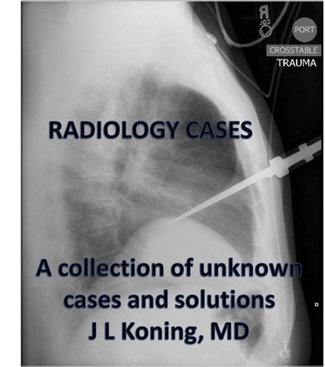 Introduction To Radiology Cases Radiology Nuclear Medicine Radiography