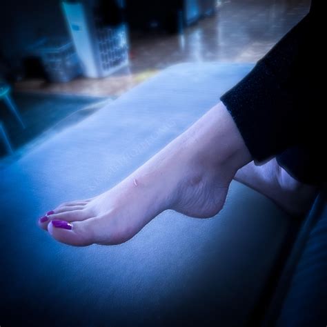 Please Kiss My Ouchie [oc] R Feetpics
