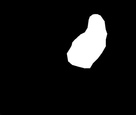 Examples Taken From The Development Part Of The Polyp Segmentation