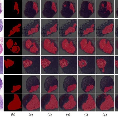 Segmentation Results On Lnm Dataset From Peer Networks A Original Download Scientific