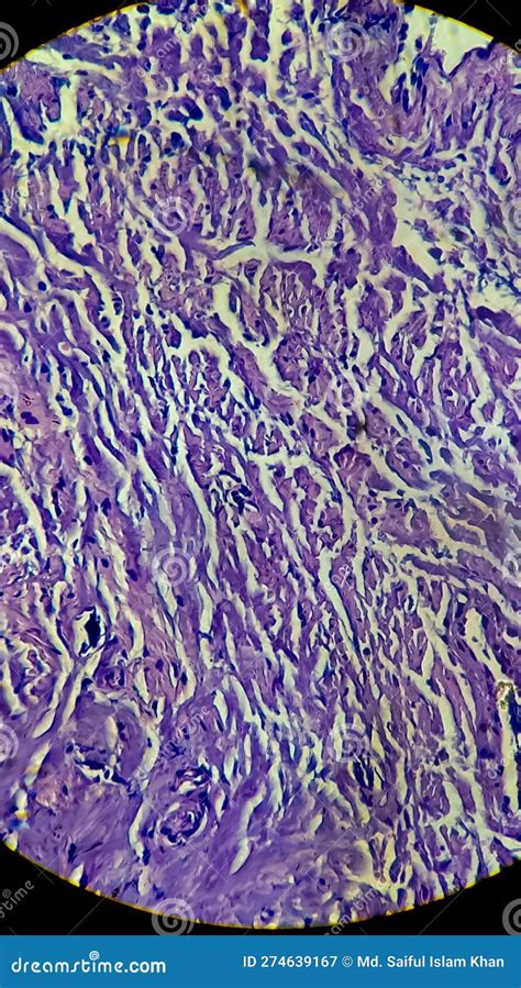 A Histological Slide Of A Tissue Sample Close Microscopic View Stock Image Image Of Leishman